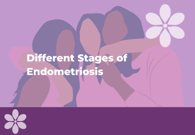 Endometriosis Stages: 4 Stages Explained - Intimate Rose